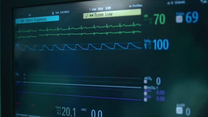 Measures, Pulses, Beats, Ecg Machine by P.P.H. – Stock Footage | Artlist