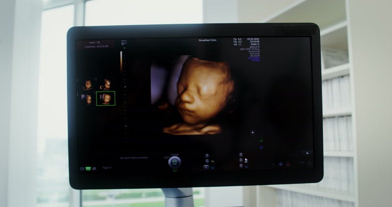 3d Ultrasound, Check Up, Fetus, Screen by M-ART production – Stock ...
