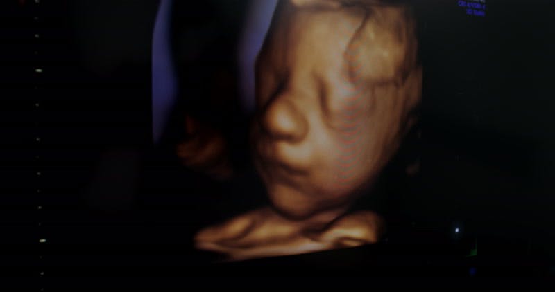 3d Ultrasound, Screen, Simulation, Check Up by M-ART production – Stock ...