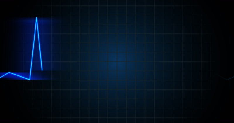 Animated, Cardiology, Pulse, Ecg by Up North Studio – Stock Footage ...