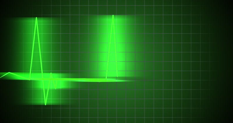 Animated, Cardiology, Pulse, Ecg by Up North Studio – Stock Footage ...