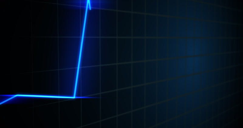 Animated, Cardiology, Pulse, Ecg by Up North Studio – Stock Footage ...