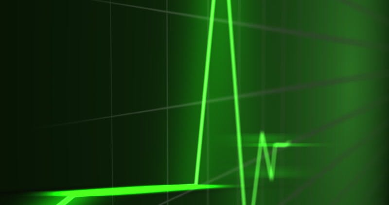 Heartbeat, Animated, Cardiology, Pulse by Up North Studio – Stock ...