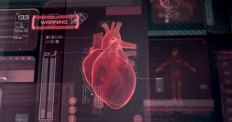 Pulse, Monitors, Infographics, Heart by Gilad Baron – Stock Footage ...