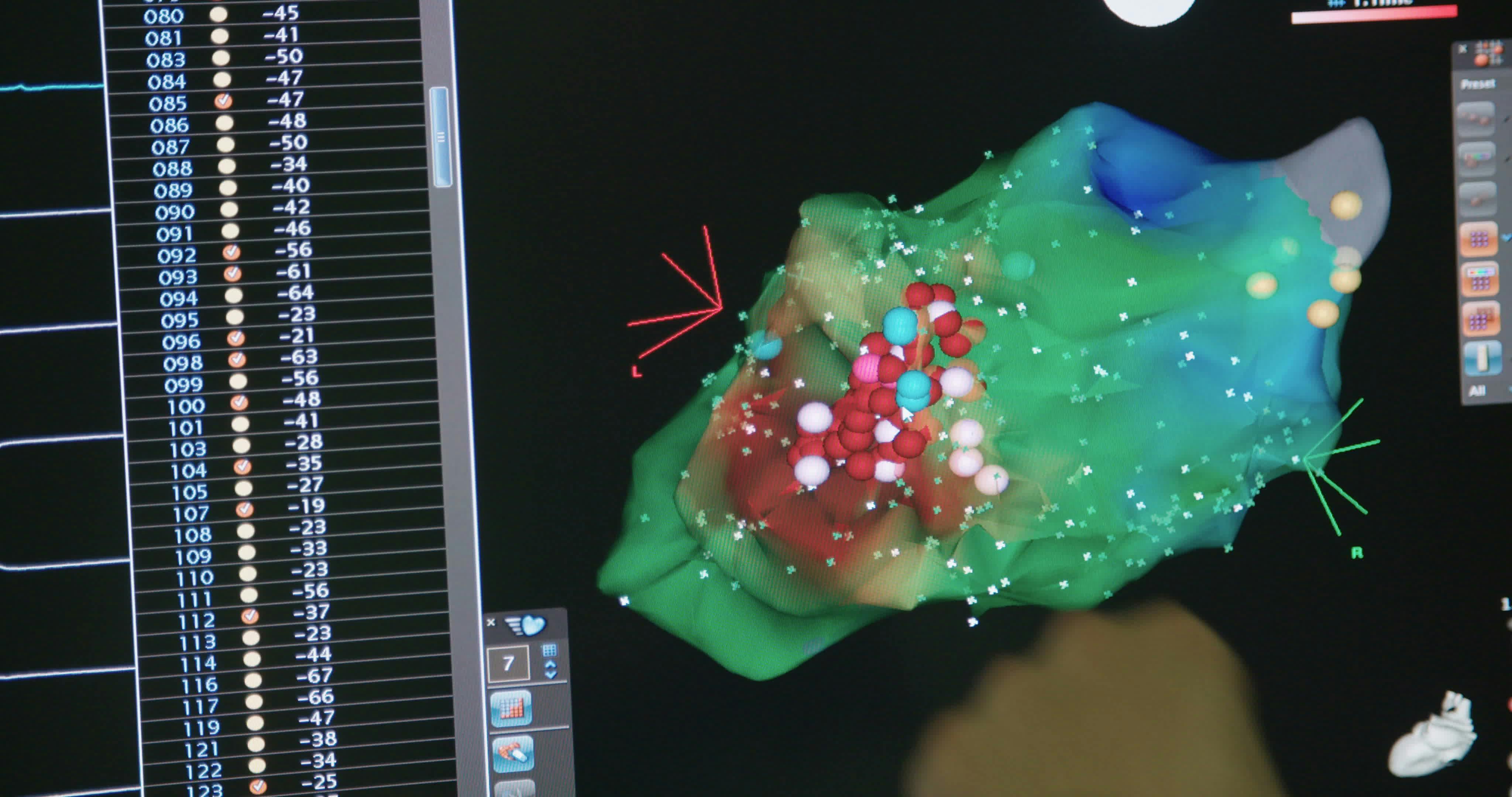 Discover advanced-cardiology, a story-driven footage | Artlist