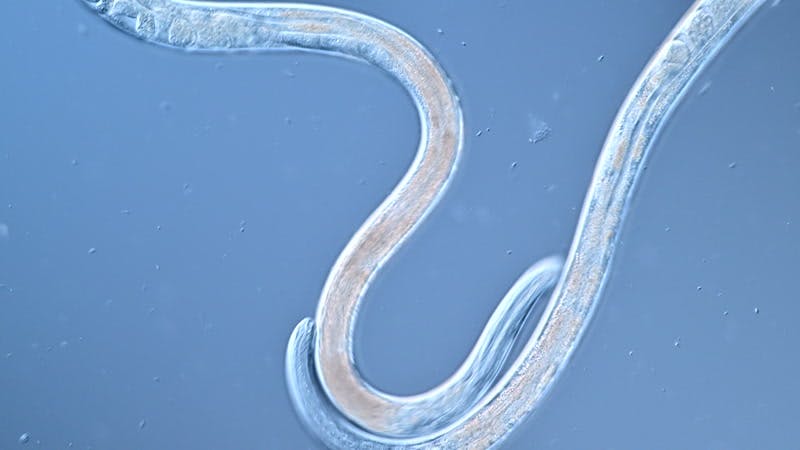 Nematodes, Microscopic, Pathogen, Worm by Benedikt Pleyer – Stock ...